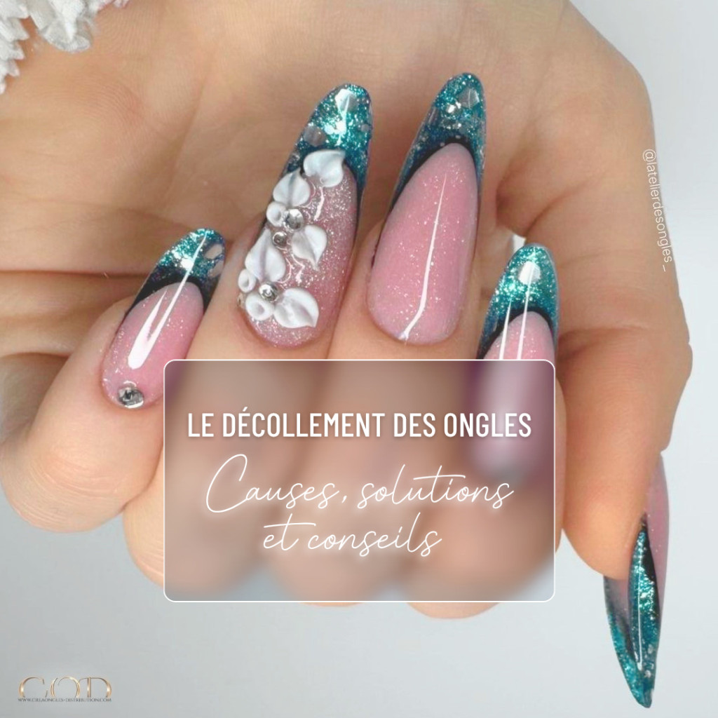Décollement des ongles : causes, solutions et conseils professionnels